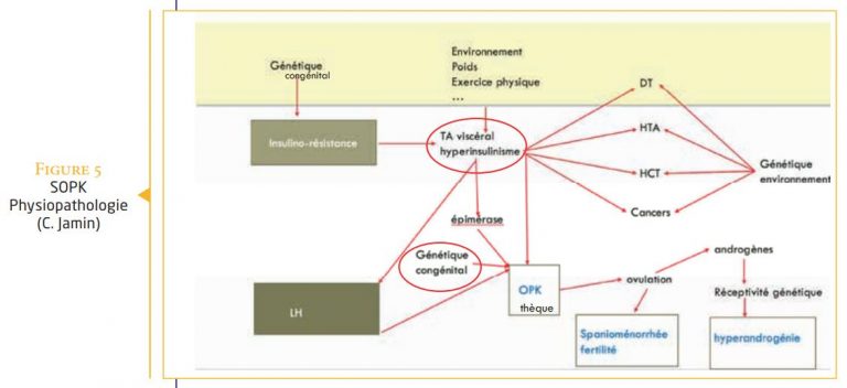 SOPK : mieux comprendre pour mieux traiter – REVUE GENESIS