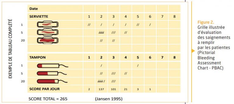 Le traitement médical des ménorragies en 2021 – REVUE GENESIS